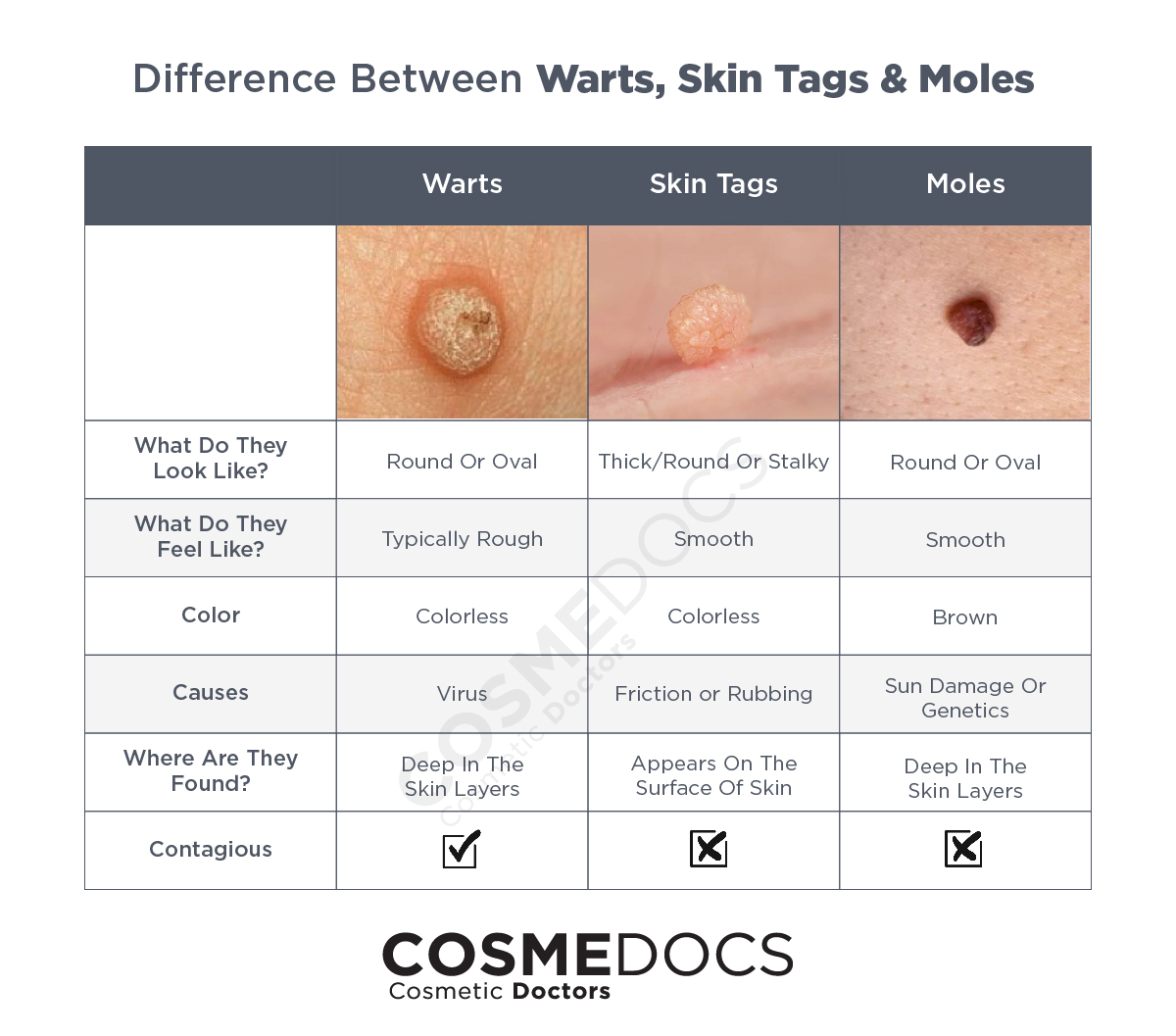 Difference Between Genital Warts And Skin Tags Difference Between Genital Warts And Skin Tags